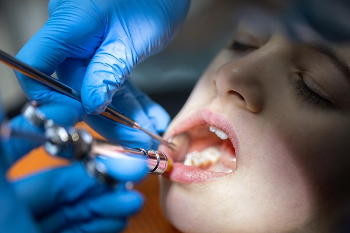 Wisdom Tooth Extraction in Phoenix, AZ | 3rd Molar Extractions